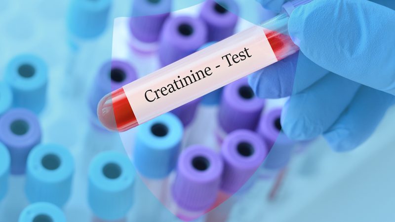 HOMA-IR: İnsülin Direnci Nedir, Nasıl Hesaplanır? – FarmaBLOG Sağlıkla ...